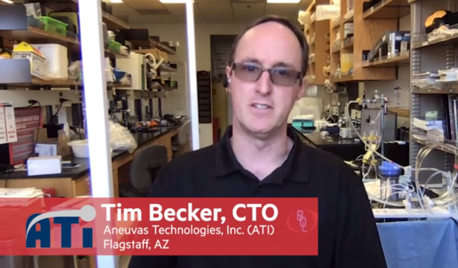 Meet Researcher - Tim Becker - Brain Aneurysm Foundation