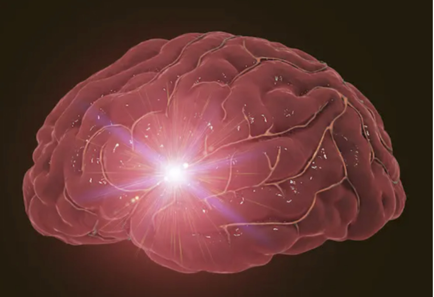 Are Brain Aneurysms Treatable and Beatable? - Brain Aneurysm Foundation