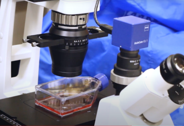 Improving Conventional Brain Aneurysm Treatments with Novel Ones ...